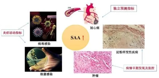 炎症检测中的CRP、SAA和PCT三者有什么区别？_金标智能分析系统_上海凯创生物技术有限公司
